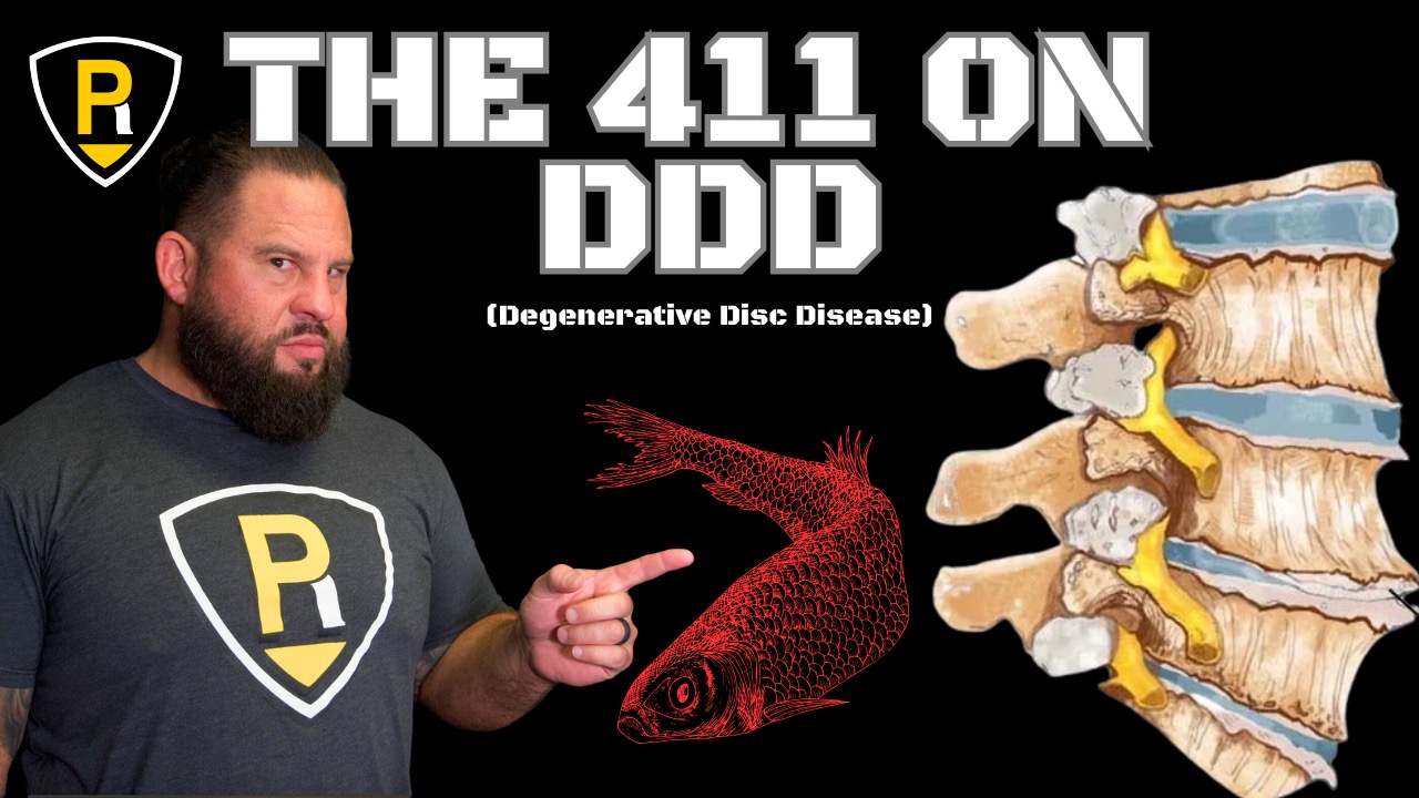 The TRUTH About Degenerative Disc Disease! (DDD) - Power Rack Strength