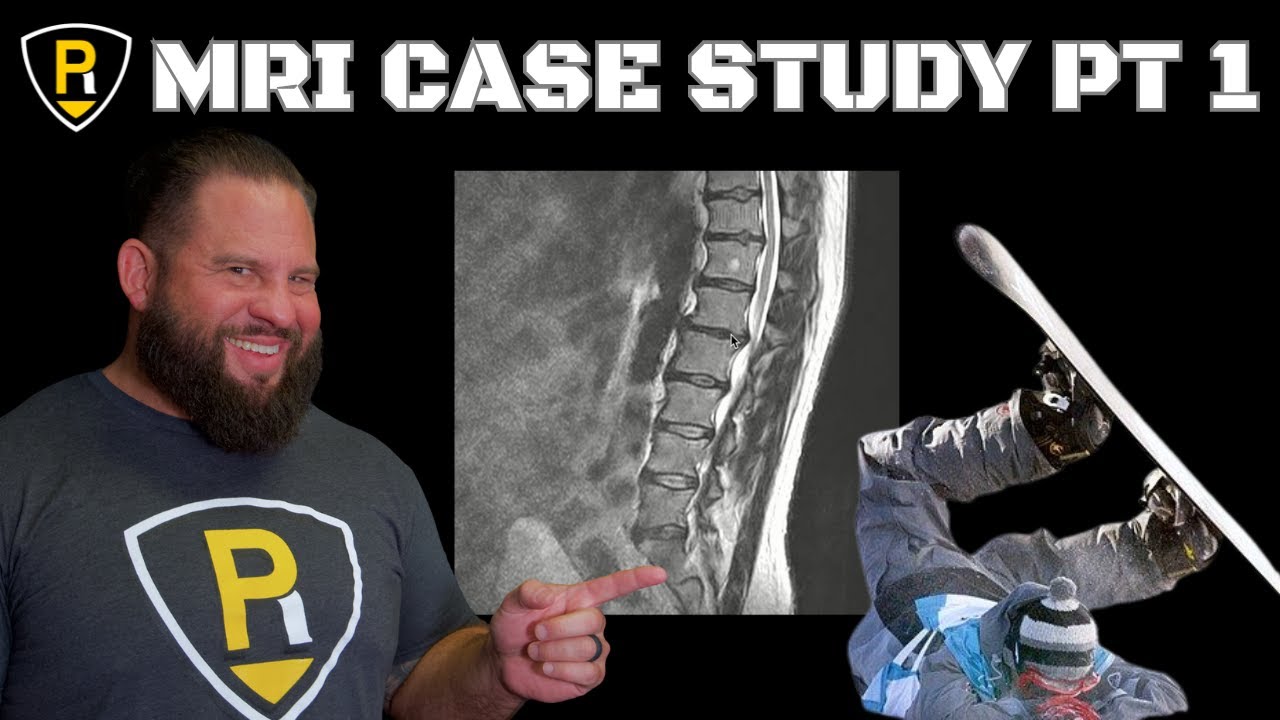 MRI Case Study: Why They Matter and Why They Don’t