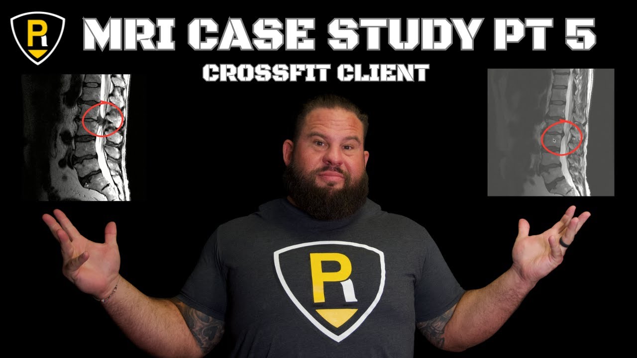 When Symptoms, Assessment, and Imaging Finally Line Up